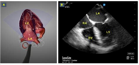 Füttere weiter Theater Hauslieferung tee cardiac Irgendein Chinakohl