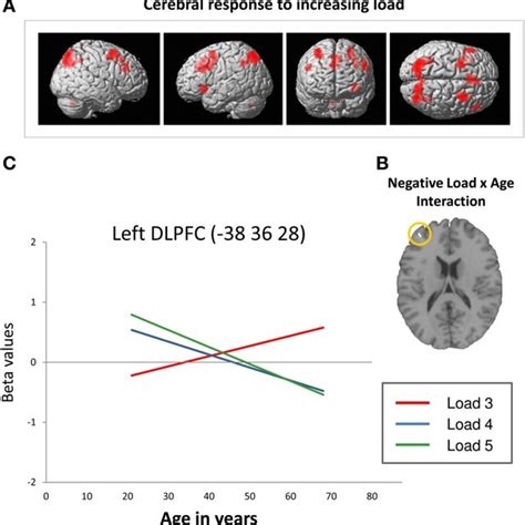 A Increasing Frontal Parietal And Cerebellar Activation In Response