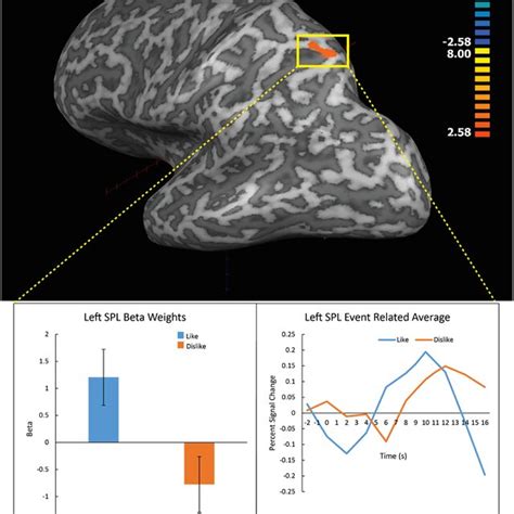Whole Brain Analysis Of Fmri Data Download Scientific Diagram
