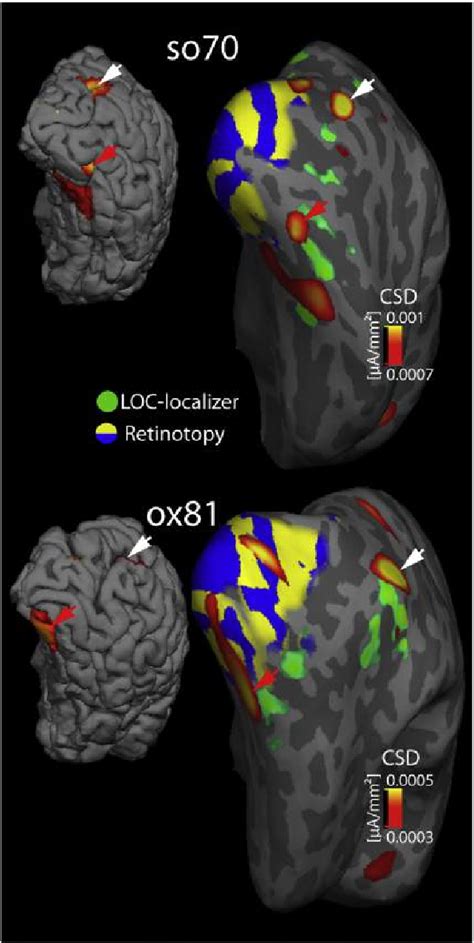 Figure 3 From Neural Sources Of Visual Working Memory Maintenance In Human Parietal And Ventral