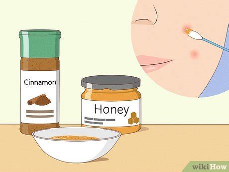 13 Ways To Reduce The Swelling And Redness Of Pimples WikiHow