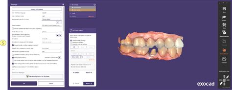 User Interface Exocad