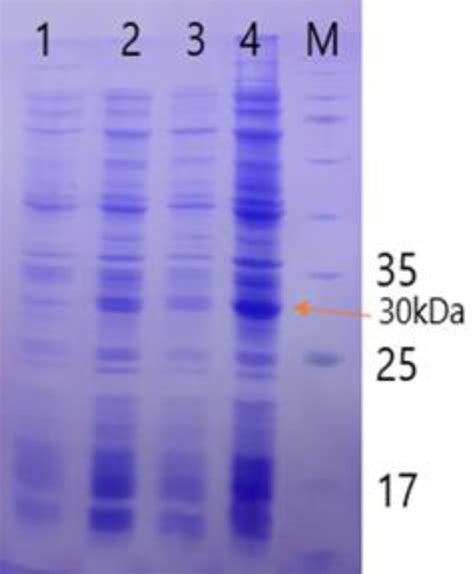 Recombinant Expression Of Sars Cov 2 Receptor Binding Domain Rbd In Escherichia Coli And Its