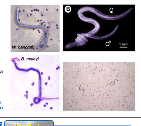 Nematodes Tissue Flashcards Quizlet