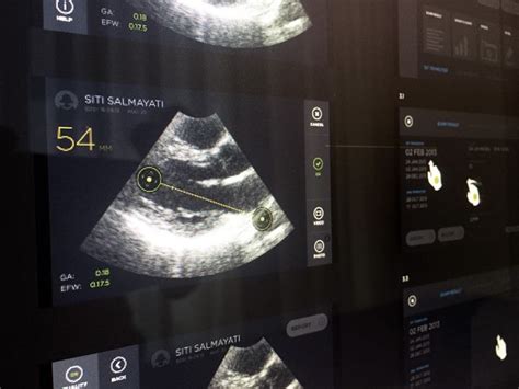 Ultrasound Medical Device Design Ultrasound Interactive Design
