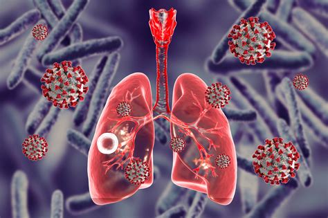 WHO End Tuberculosis Strategy Progress Stalled In Light Of COVID 19