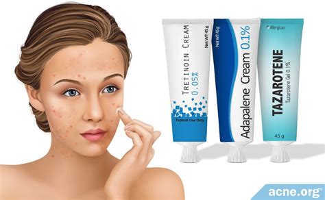 Tretinoin Cream Before And After Acne