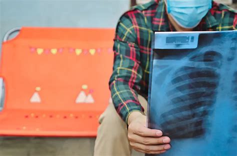 Faktor Risiko Pneumonia