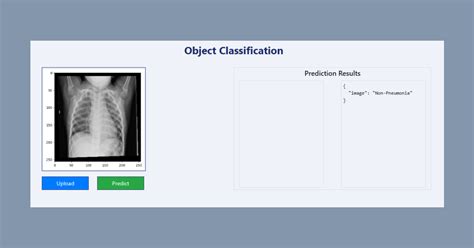 Leveraging Deep Learning For Pneumonia Detection In Chest X Rays Francisco Carmona