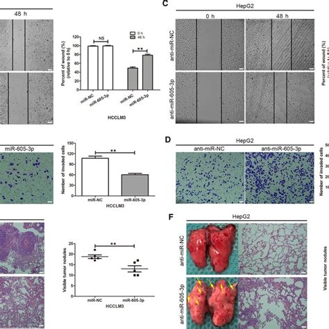 Mir‐605‐3p Inhibits Hcc Cell Migration And Invasion In Vitro And In