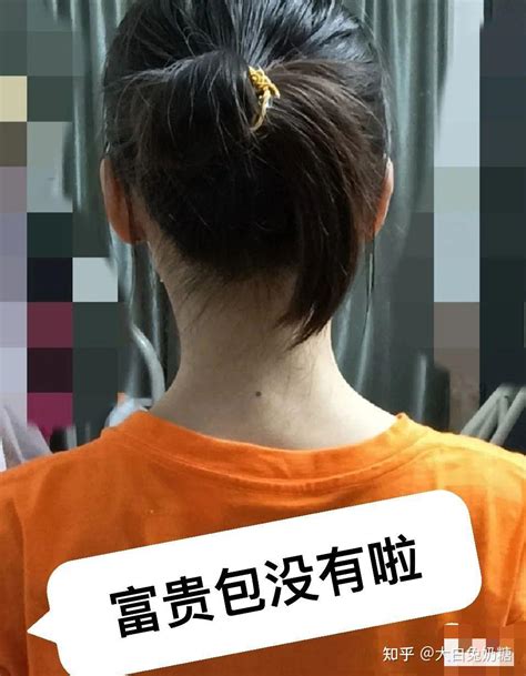 折磨我好久的富贵包没有啦，好开心 知乎