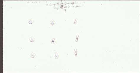 Thbs1 Rna In Situ Gene Expression Assay Gxd