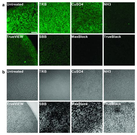 Reducing Green Wavelength Autofluorescence In Pfa Fixed Mouse Adrenal