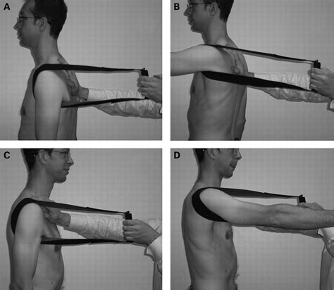 Rotator Cuff Impingement Syndrome