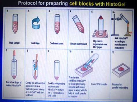Cell Block And Liquid Based Cytology PPTX