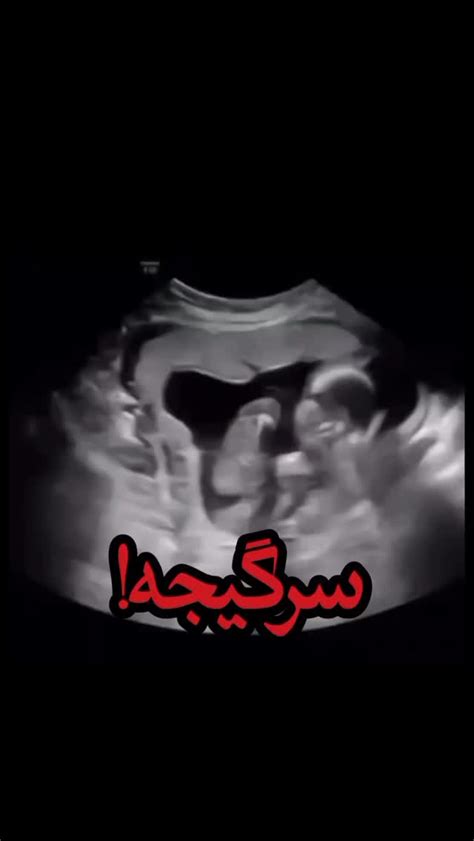 ‎🥀سپیده جاوید🥀نویسنده داستان های واقعی 😎‎ ‎راضی نیستم بدون لایک بخونی