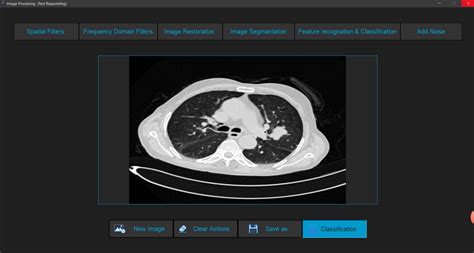 Github Ayazakymri Based Brain Tumor Classification Desktop