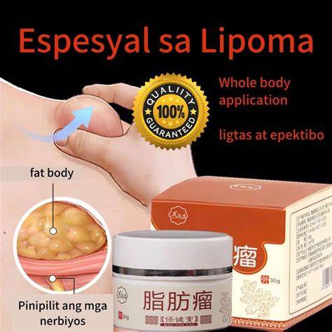 Lipoma Removal Cream Tumor Removal Cream Lipoma Ointment Eliminate