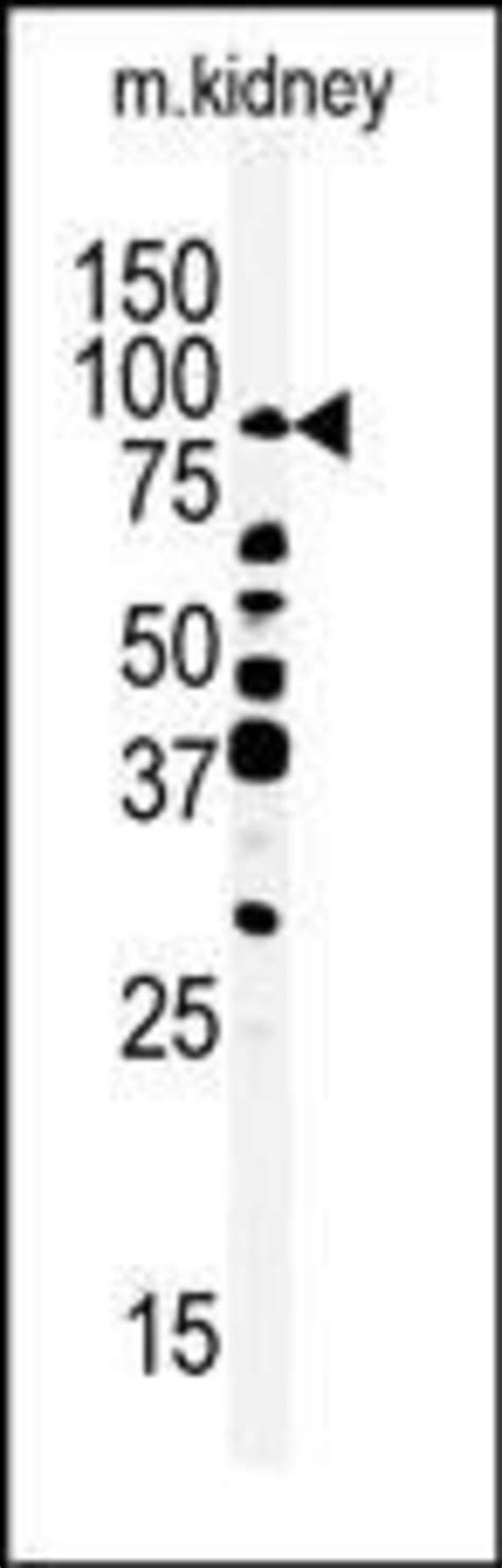 Ripk4 Polyclonal Antibody Invitrogen 400 μl Unconjugatedantibodies