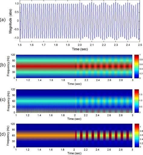 A Normalized Voltage Waveform Containing Flickers Of 10 Hz 20