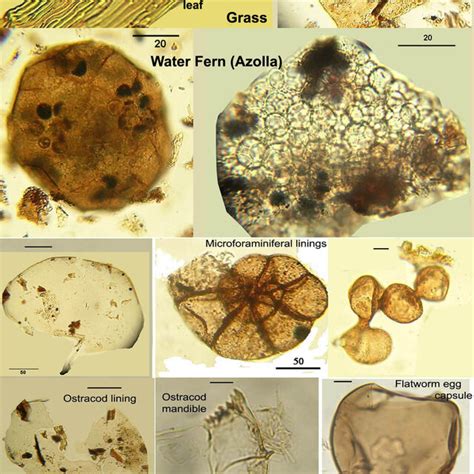 Light Microscope Photographs Of Plant Materials In Peat Samples Used