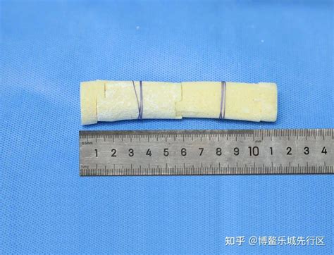 一天4例再生定制骨手术在博鳌乐城常态化开展为骨缺损患者带来先进治疗方案 知乎