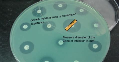 Science A Revision Site For Babes From A Babe Disk Diffusion Method