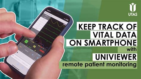 Univiewer — Remote Monitoring Of Vital Data With Um 300 Patient Monitors Youtube