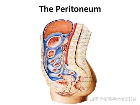 变性手术的方法 知乎