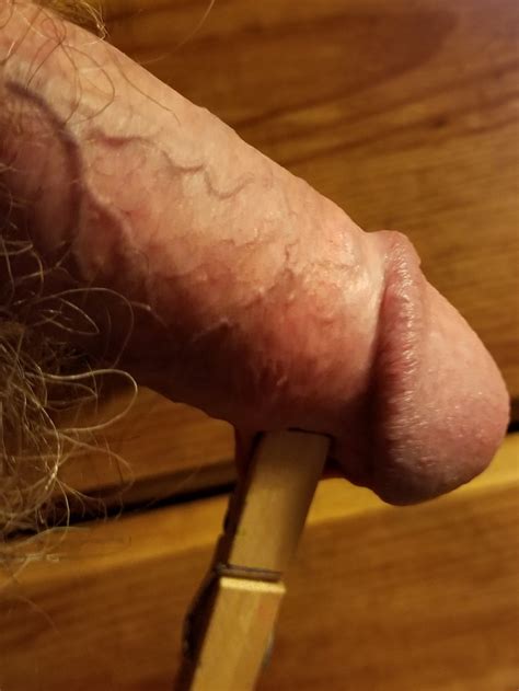 Its Weiner Wednesday Page 4 Xnxx Adult Forum