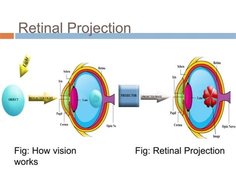 Screenless Displays Visualimage Retinaldisplay Synapticdisplays Ppt