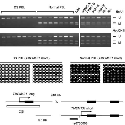 Microarray Analysis Of Dna Methylation In Ds Versus Normal Pbl A
