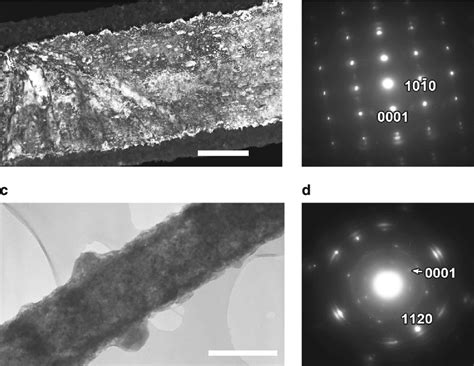 Transmission Electron Microscopic Tem Images And Selected Area
