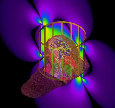 Em Simulation Software For Biomedical Devices Remcom Inc Posted On The Topic Linkedin