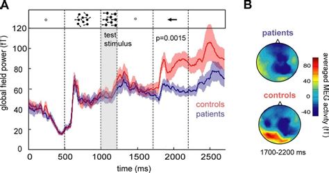Time Course Of Gfp And Spatial Distribution Of The Meg Responses A Download Scientific