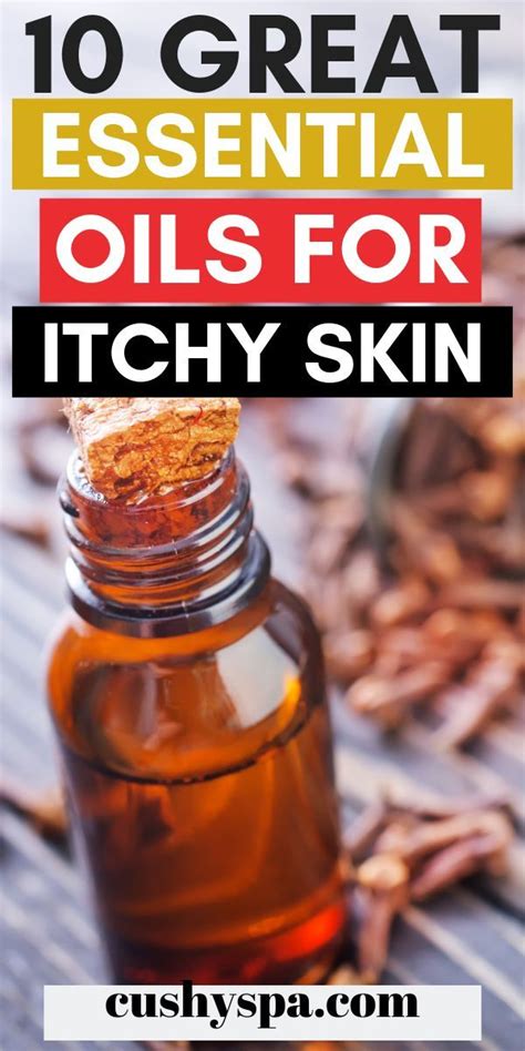10 Essential Oils For Itching According To Science And More Artofit