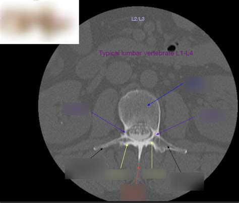Thoracic Spine Axial 2 Diagram Quizlet