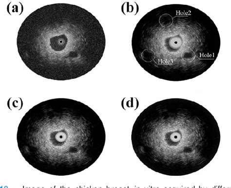 Figure 10 From An Improved Chirp Coded Excitation Based On Compression
