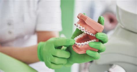 치과 의사는 인공 턱 모델을 사용하여 교정기가 치아를 교정하는 방법을 보여줍니다 사진 Unsplash의 치과 건강 이미지