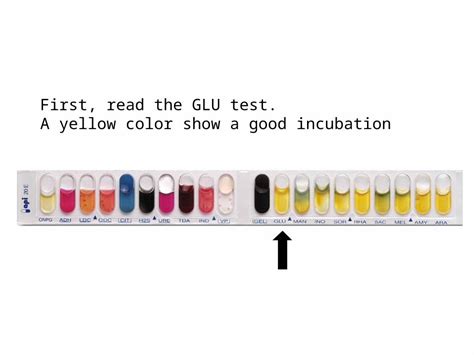 Ppt Bacterial Identification Procedure Part 2 Reading Of Api System Dokumen Tips