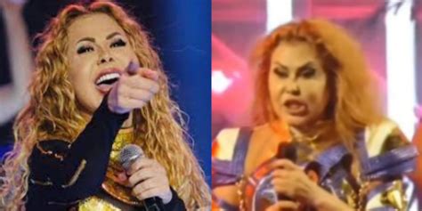 Joelma surge rosto completamente desfigurado e doença desespera