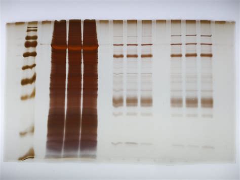 160 Questions With Answers In Silver Staining Science Topic