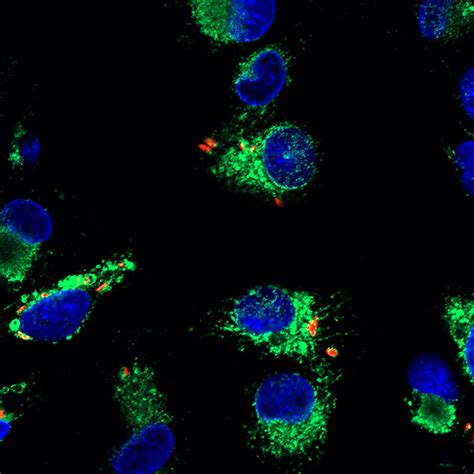 Inflammation Signaling Pathways Schlesinger Lab