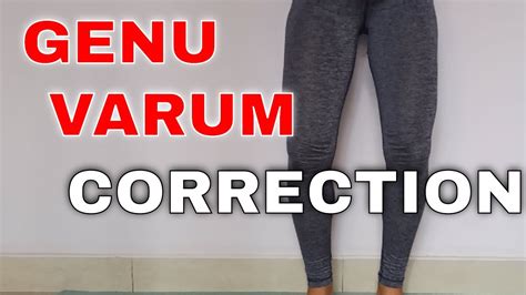 5 Genu Varum Correction Exercises Yoga For Bow Legs Youtube