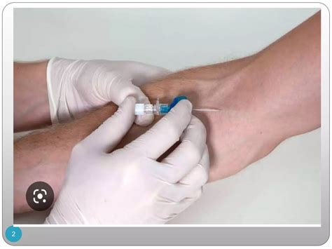 Intravenous Cannulation Procedure Pptx