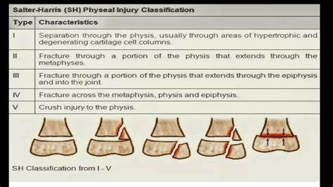 Structure Of Physis Pptx
