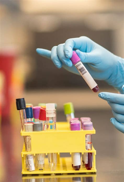 Matched Biospecimen Sets Ispecimen