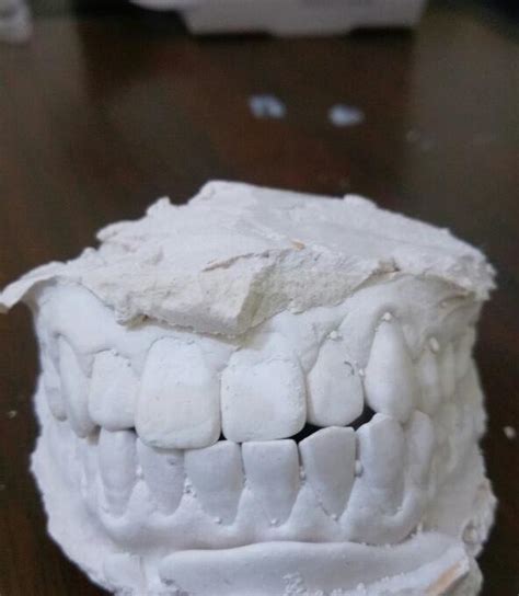 牙齿矫正 医联