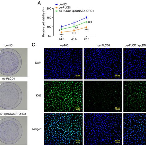 Overexpression Of Plcd1 Inhibits Lung Adenocarcinoma Cell Download
