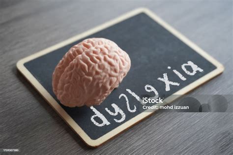 인간 뇌 모델의 근접 촬영 이미지와 텍스트 Dyslexia가 있는 칠판 0명에 대한 스톡 사진 및 기타 이미지 0명